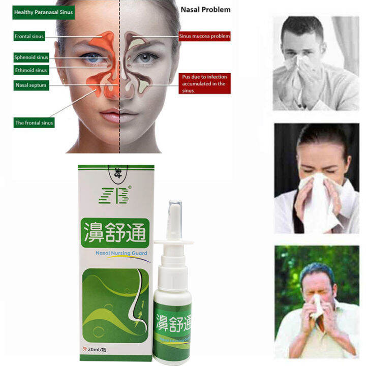 ZB Nasal Sprays Chronic Rhinitis Sinusitis Sprays Nose care Chinese ...