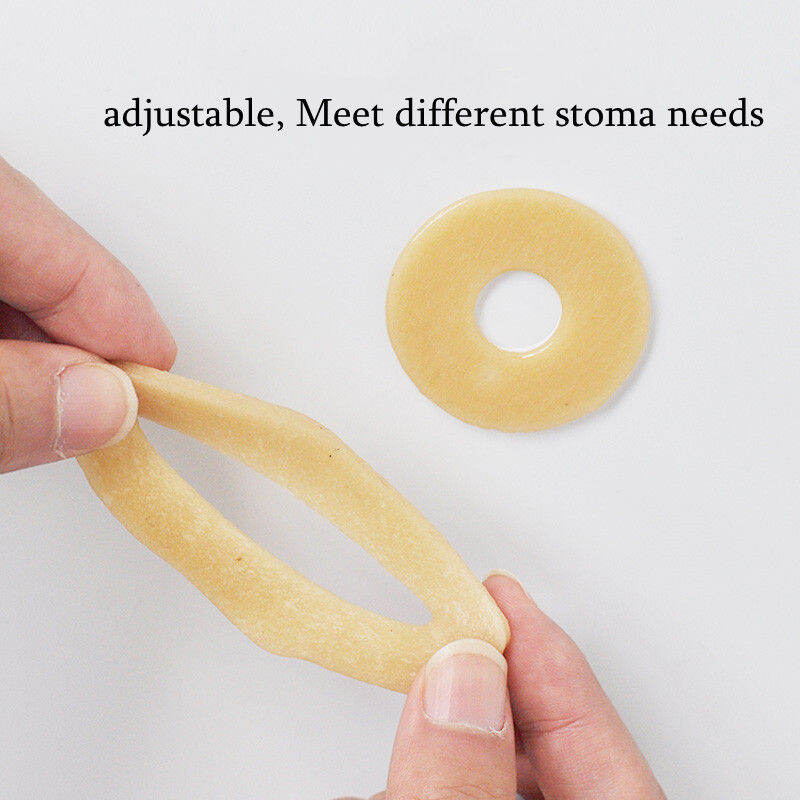 10 Pcs Ostomy Barrier Rings Hydrocolloid Absorb Moisture Skin Friendly ...