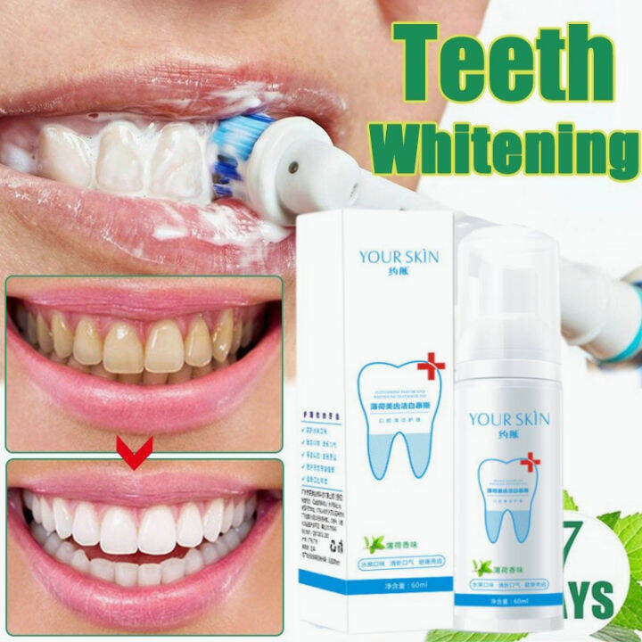 Teeth Whitening Mousse Cleansing Teeth Mousse Remove Tartar Oral ...