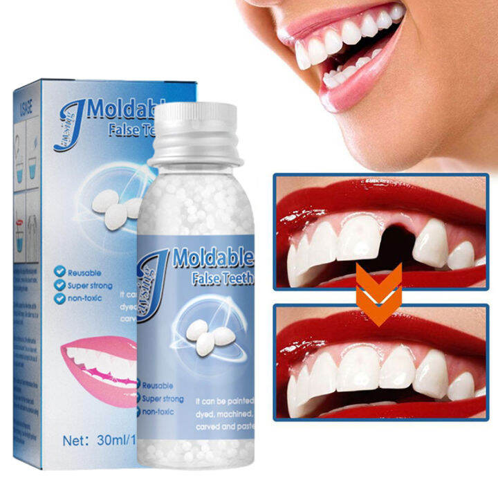 Temporary Tooth Repair Kit Teeth Restoration Temporary Resin False ...