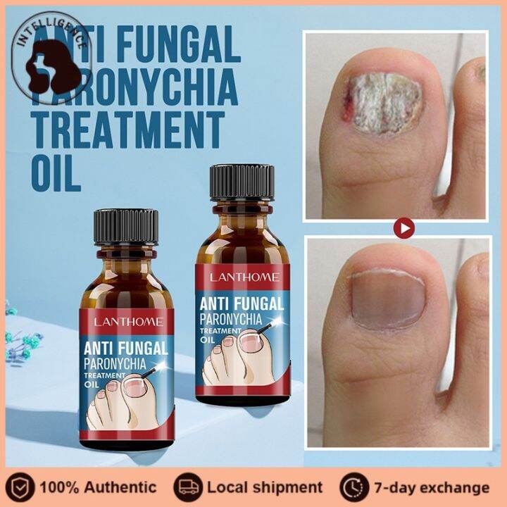 🎀🎀IE 10ml Original Lanthome Fungal Nail Treatment Effective Nail Repair ...
