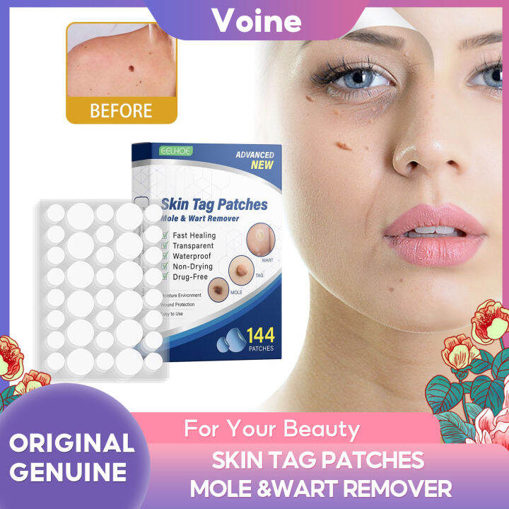 Eelhoe Ke Wart Patch Skin Label Remover Patch Ke Wart Flesh Nevus Black ...