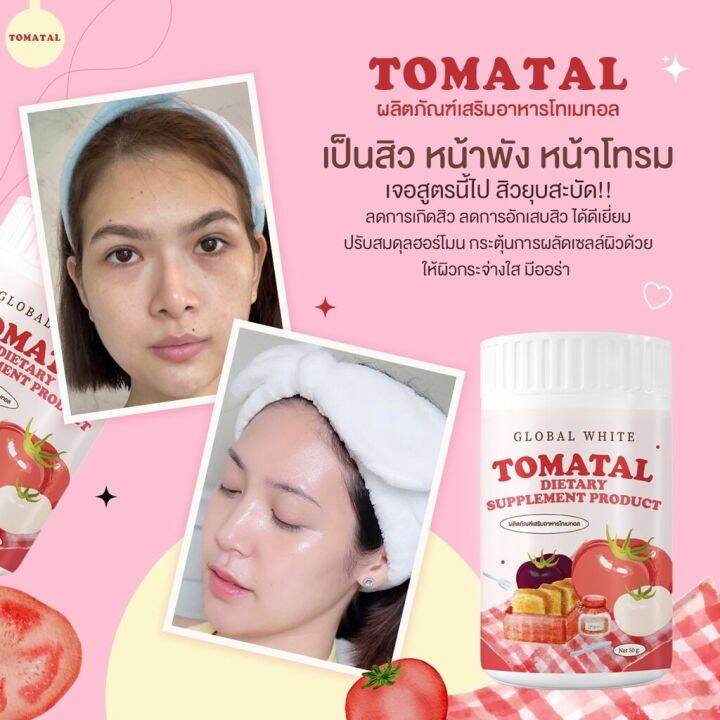 เครื่องดื่มน้ำชง TOMATAL น้ำชงมะเขือเทศ 3 สี น้ำชงมะเขือเทศ คอลลาเจน ...