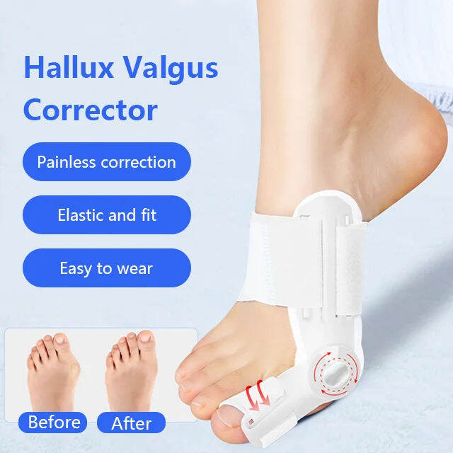 guinian Hallux valgus correction splint | Lazada PH