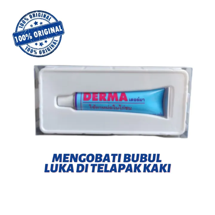 Derma cream obat bubul ayam/ obat bubul gantung | Lazada Indonesia