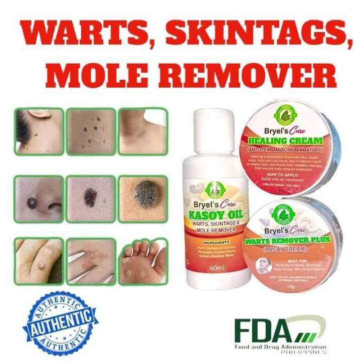 ⚡ ⭐ WART REMOVER SET 3 IN 1 Pure Organic Authentic Kasoy Oil Warts ...