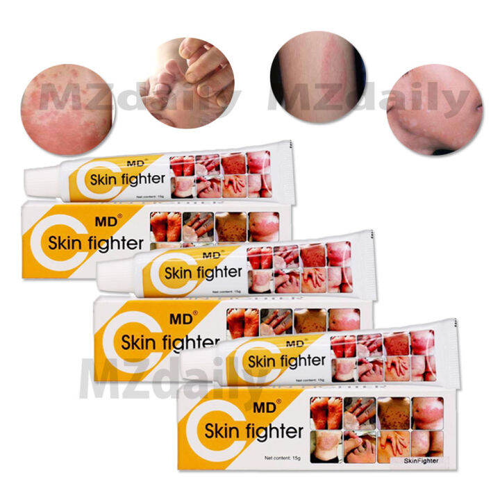 SET 3 Original MD Skin Fighter Cream for Skin Allergies or Fungis 15gm ...