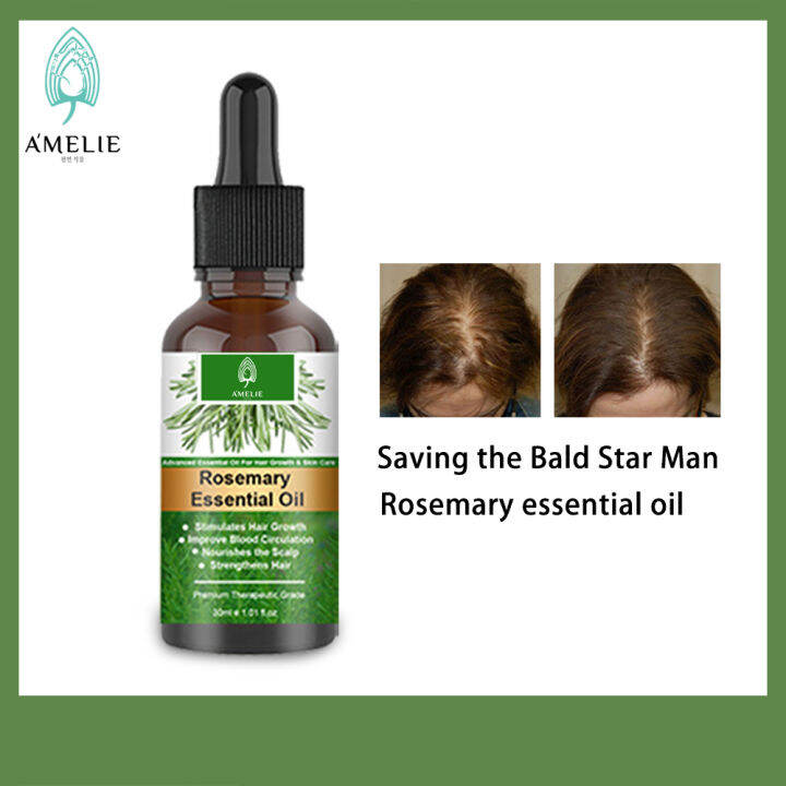 AMELIE Original Hair Growth Essential Oil Anti Hair Loss Rapid ... AMELIE Original Hair Growth Essential Oil Anti Hair Loss Rapid ...