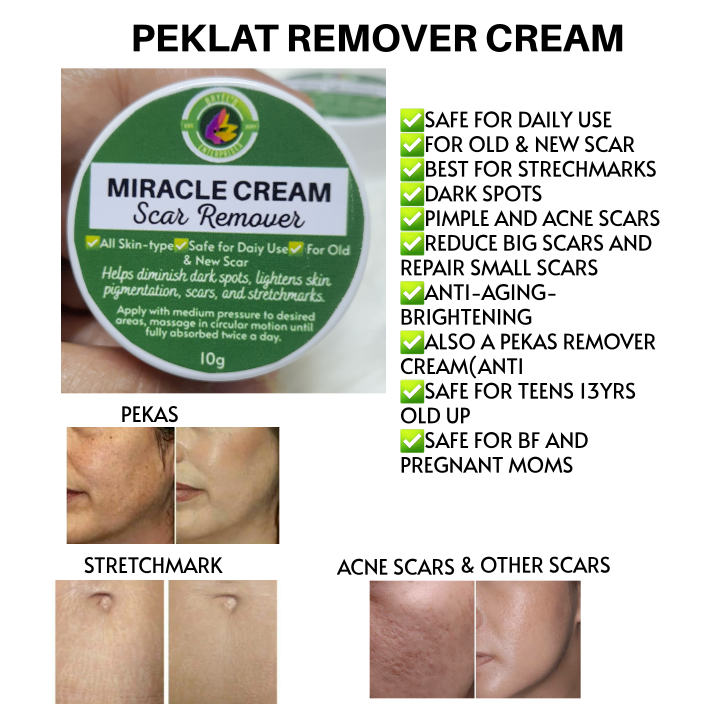 BRYELS CARE 10G MIRACLE CREAM (SCAR REMOVER CREAM) PEKLAT CREAM ANTI ...