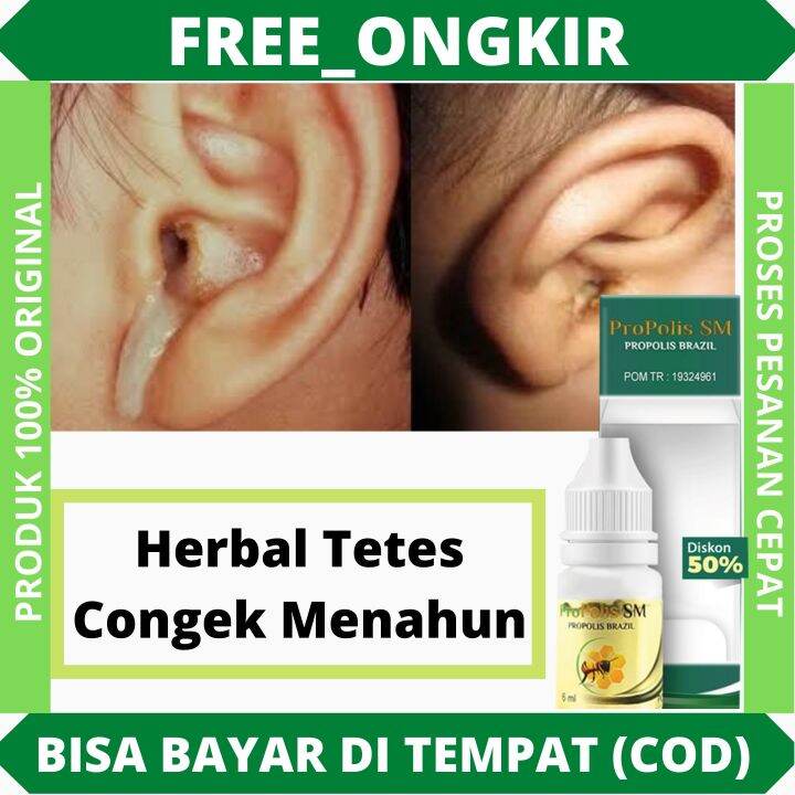 Obat congek meler | Berkhasiat bertesti - Cairan bau dari telinga ...