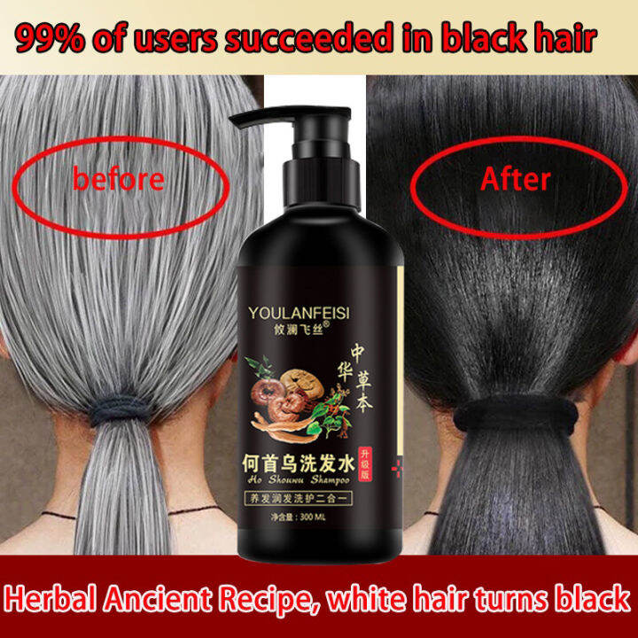 Grey Hair Shampoo Effective White Hair Turns To Black Herbal Natural Polygonum Multiflorum ...