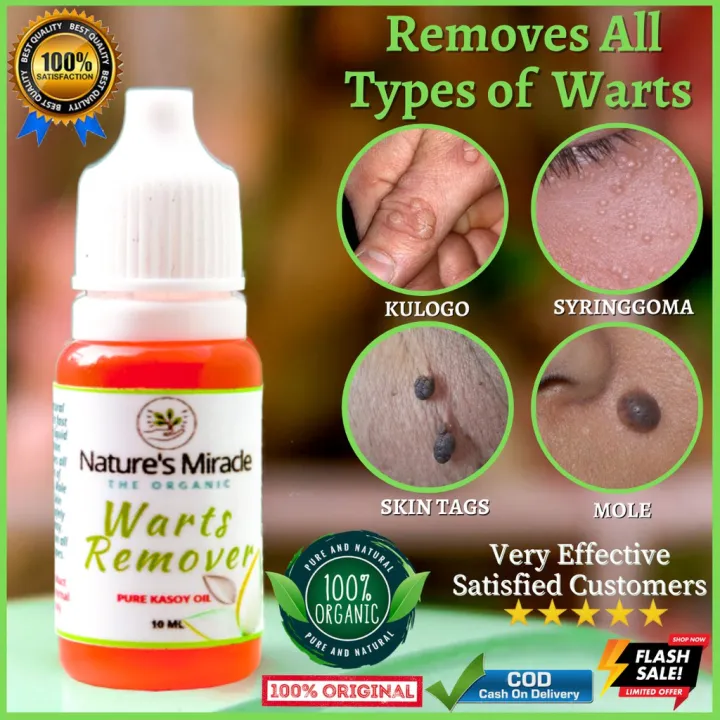 ♜Warts Remover Very Effective Kasoy Oil for Warts(Kulogo), Mole(Nunal ...