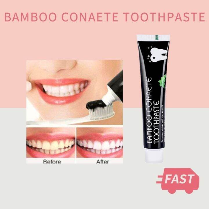 [Hot sales]∈ Tiktok Teeth Toothpaste Whitener Tooth Paste 105g | Lazada PH
