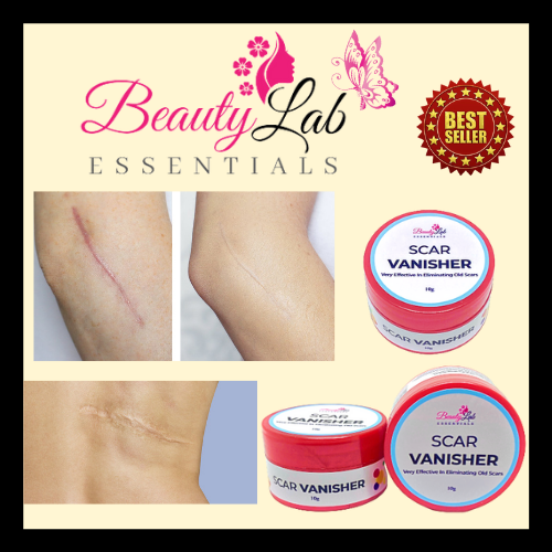 PH HERBAL SOLUTION | Scar Removal Cream (10g) | Beauty Essentials ...