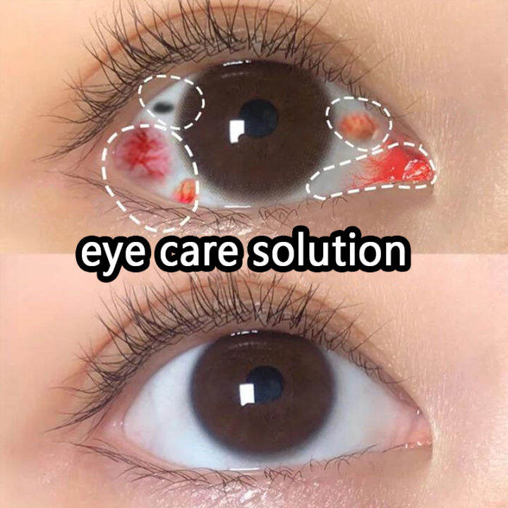 Eye Wash Care Relief eye Fatigue eye cleaner solution eye drops ...