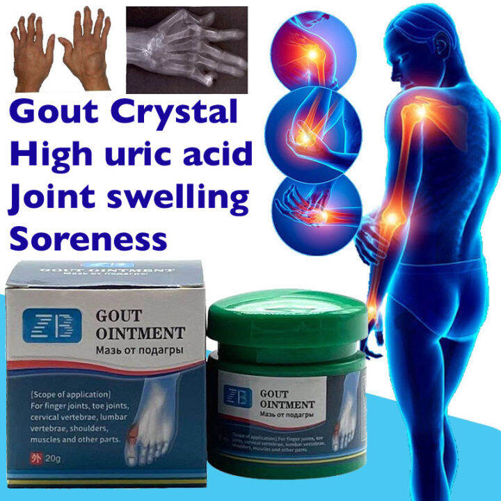 Gout Ointment Cream Effective for Joint, Knee, Toe,Finger Pain&Bone ...