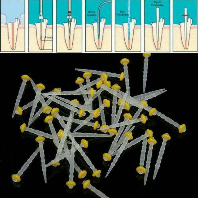 Alice dental // refill fiber post fiberpost ecer/ pasak gigi kuning ...