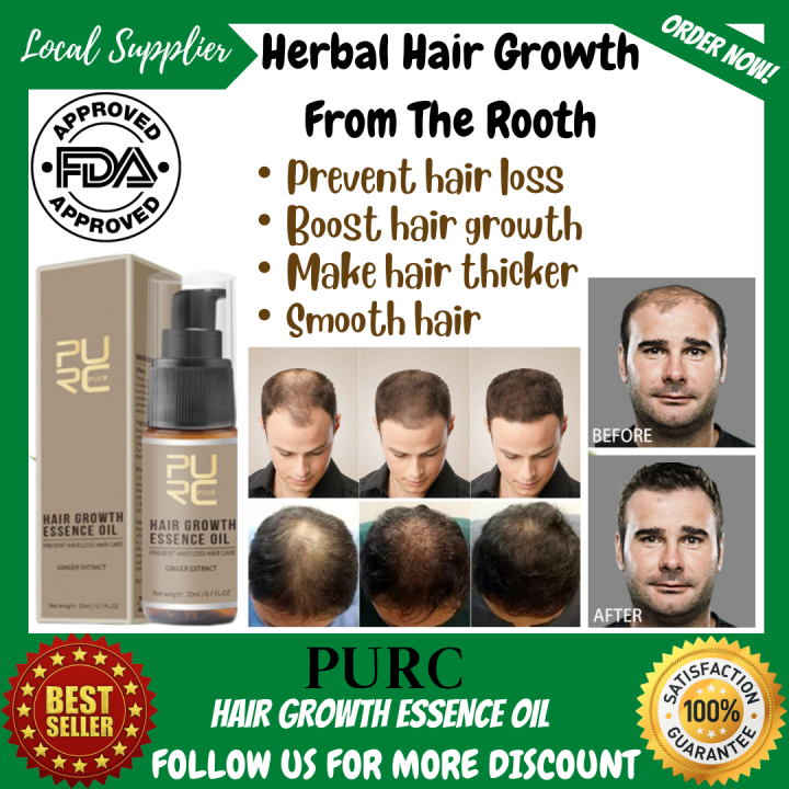 Purc Hair Growth Serum 6 Days Fast Hair Growth Spray Hair And Scalp