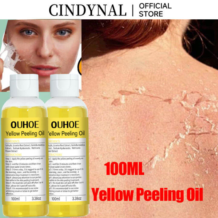 [CINDYNAL] Effective OUHOE Yellow Peeling Oil 100ML Skin Peeling - Body ...