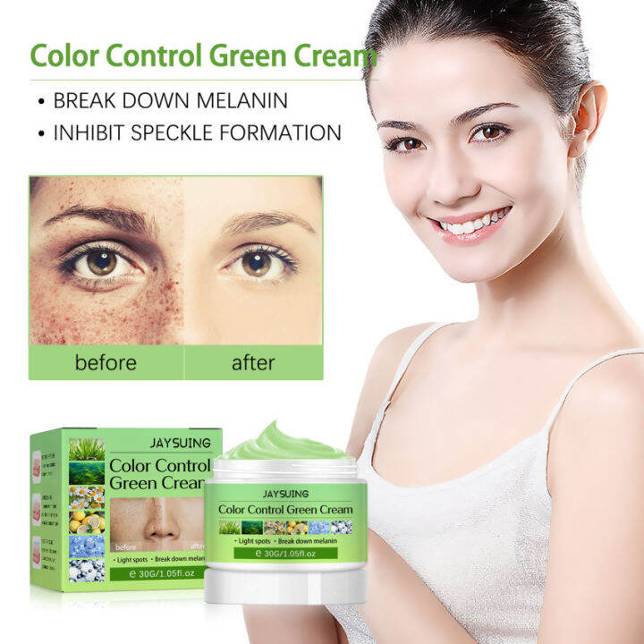 【TOPQSC x In Stock】Whitening Freckle Cream Dark Spot Corrector Cream Powerful Removing Melasma ...
