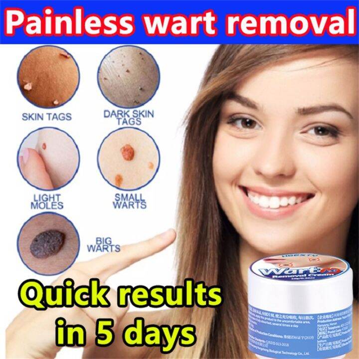 Warts Remover Original Cream Painless wart remover ointment 20g ...