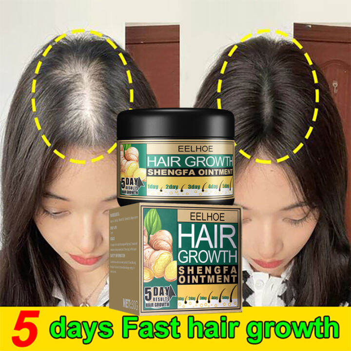 Original EELHOE 5 Days Ginger Hair Growth Care Ointment Hair Growth ...