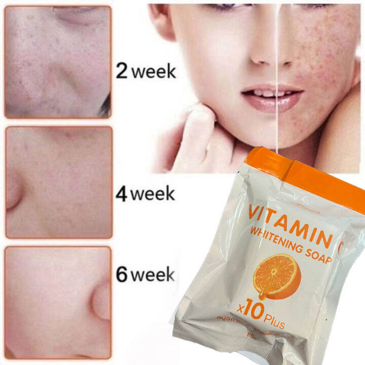 Perfect Skin Lady's Vitamin C Soap: The Ultimate Whitening Powerhouse ...