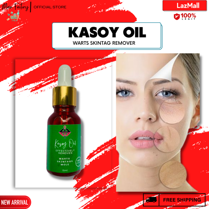 [Pure And Natural Kasoy Oil Warts Remover Warts and Skin Tags Remover ...