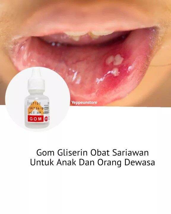 OBAT AMPUH SARIAWAN GOM OBAT CAIR SARIAWAN-Glycerine 8 ml Gom Gliserin ...