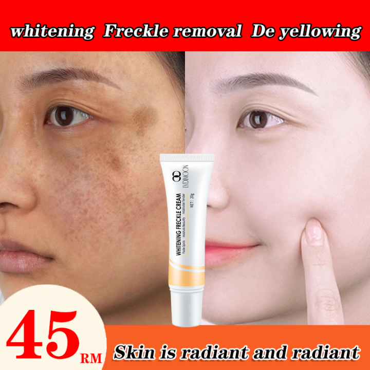 Freckle Removing and Whitening Cream for Yellowish Brown Spots and ...