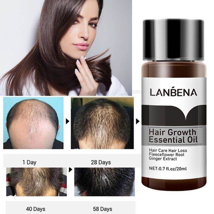 Hair Grower For Men Original Lanbena Hair Growth Essence Spray Product