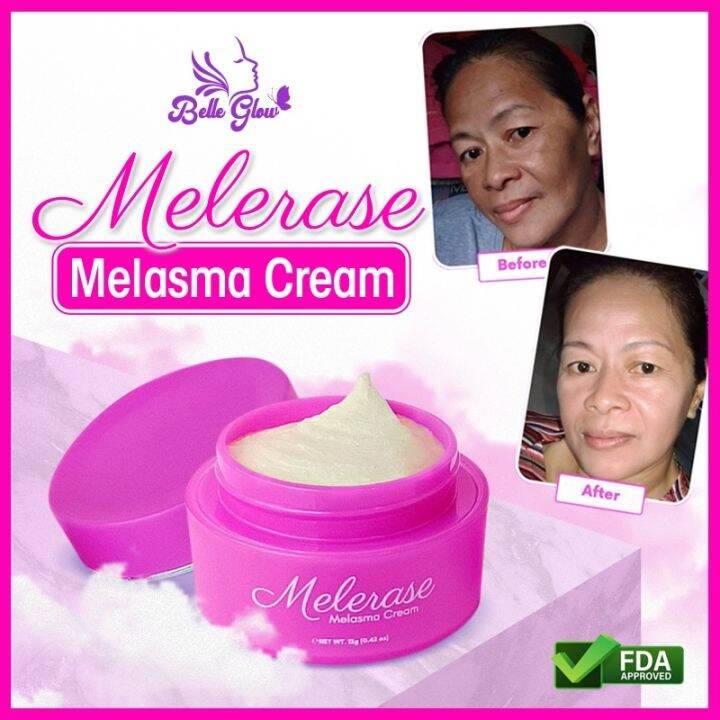 Melasma Cream Pekas Remover Authentic Melerase by Belle Glow 12g ...