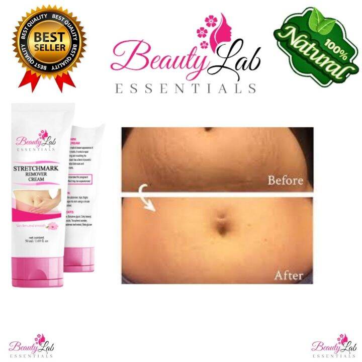 STRETCH MARK REMOVAL CREAM (50ml) / Beauty Lab Essentials / Proven to ...