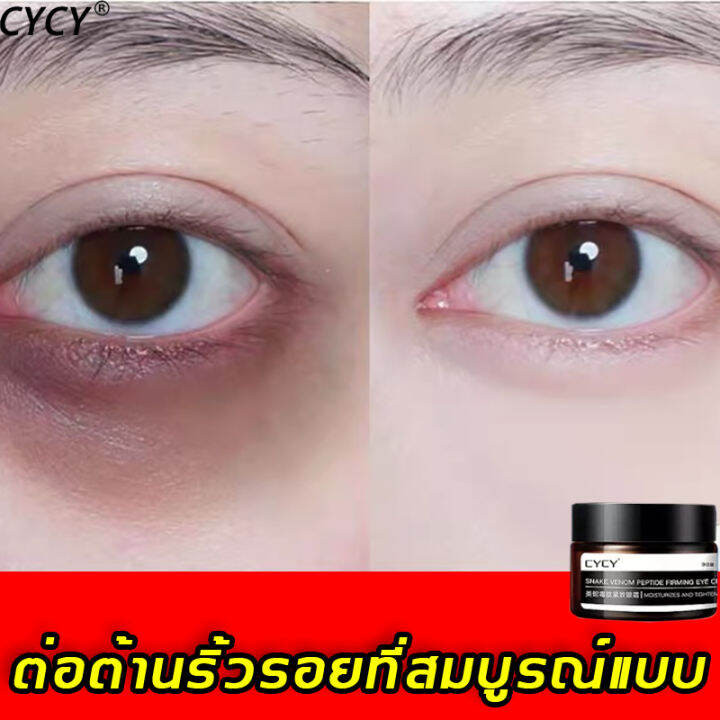 【ลดราคาครั้งใหญ่】CYCY อายครีมบำรุงตา ครีมลดถุงใต้ตา 30g,ลบเลือนรอยคล้ำ ...