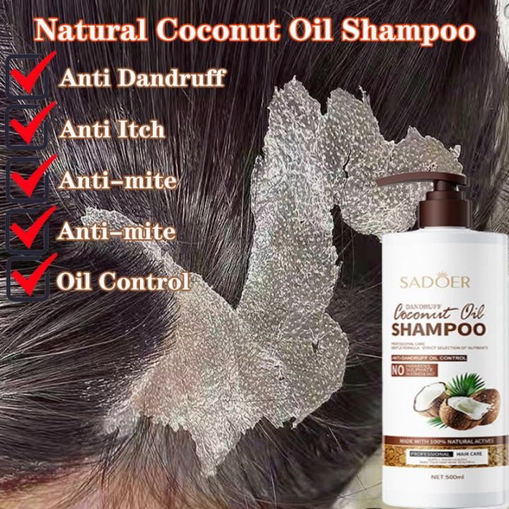 Shampoo Kelemumur Anti Dandruff Shampoo Coconut Shampoo Psoriasis