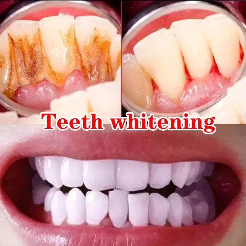 Make a friend Teeth white teeth sp4 toothpaste Probiotics oral shark ...