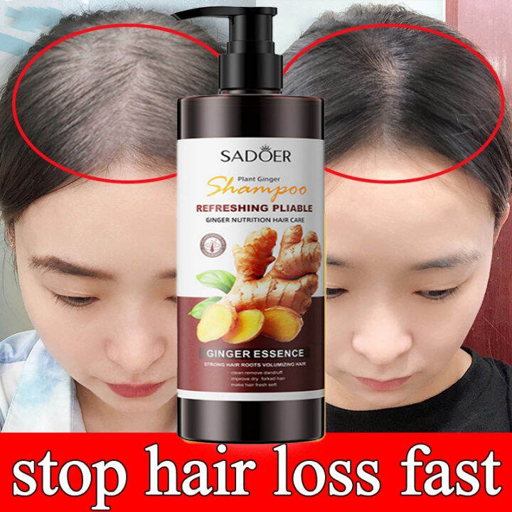 Ginger Hair Shampoo Anti Hair Loss Nourish Hair Fast Growth Shampoo Oil Control Anti Dandruff