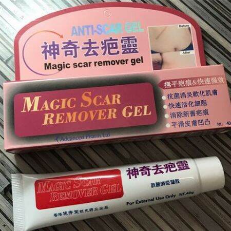 magic scar remover gel MABILIS AT EPEKTIBO NA PANG PATANGGAL NG KAHIT ...