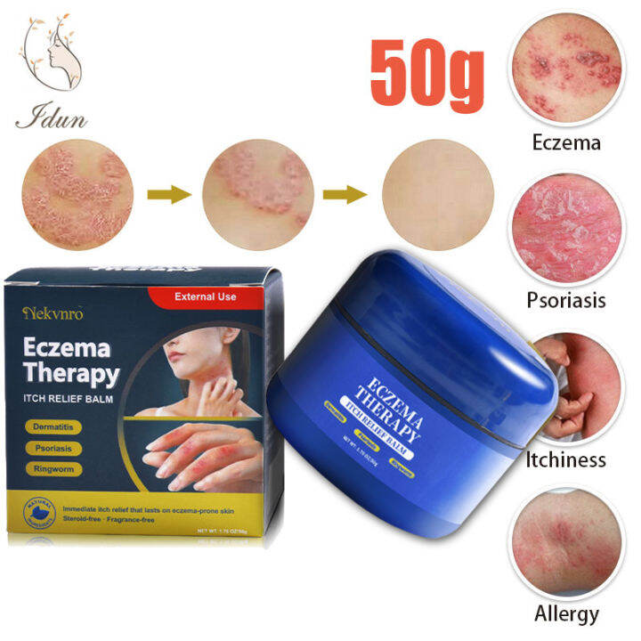 Buy 1 Take 1 50g Psoriasis Cream Eczema Ointment Antifungal Ointment ...