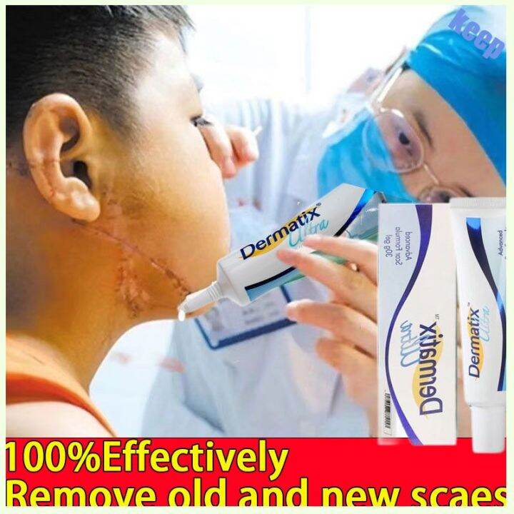 Keepyoung Dermatix Ultra acne Scar Formula 15g Acne Treatment Remove ...