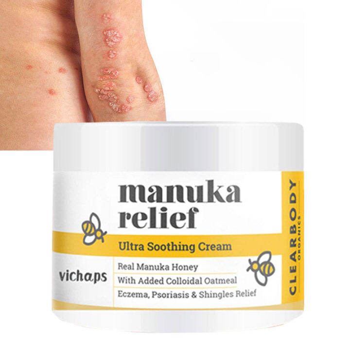 Treatment Cream 50g For the treatment of skin allergies, itchy skin ...