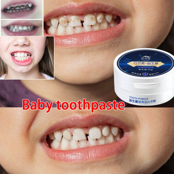 1 week whitening Probiotic tooth cleaning powder 50g tartar remover ...