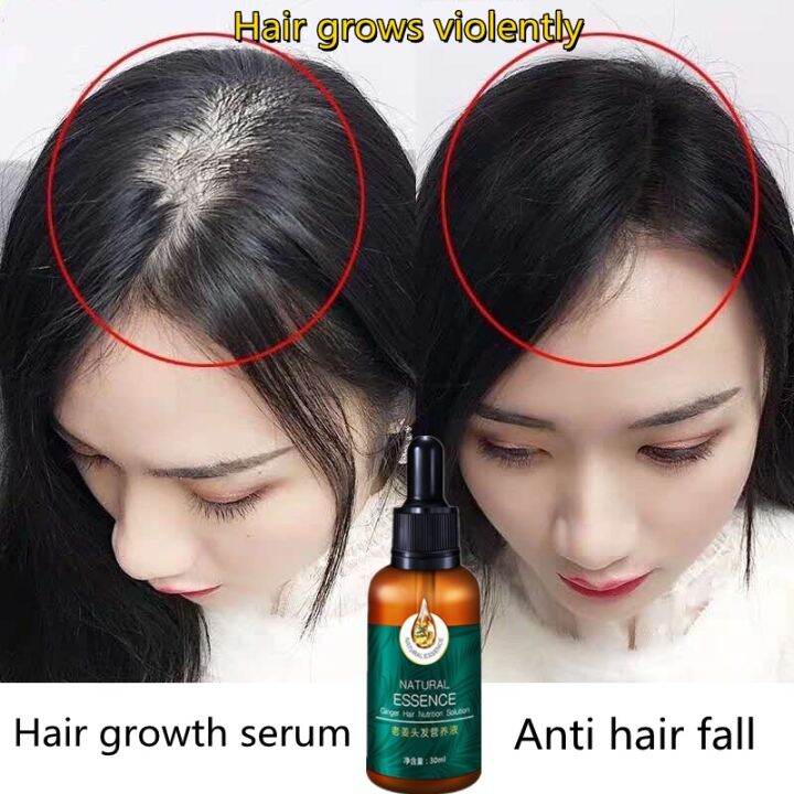 Shampoo Ginger Shampoo Hair Growth Shampoo Prevent Hair Loss Anti Dandruff Shame Ginger