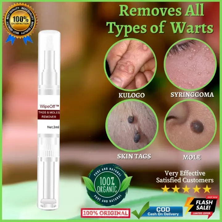 flash sales Body Wart Removal Pen Skin Tag Removal Pen Set Wart Removal ...