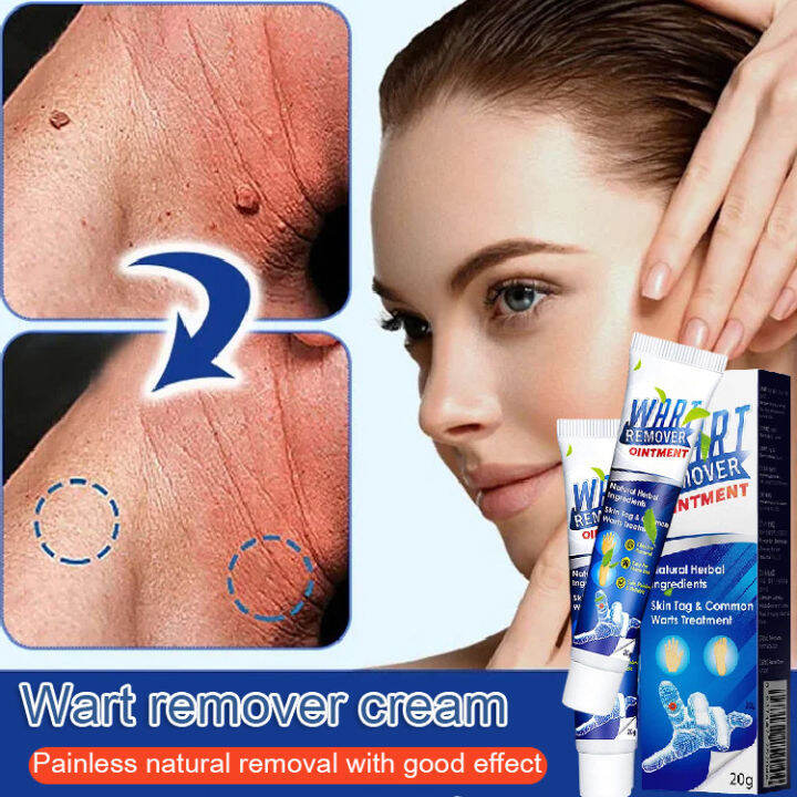 jjmakro Skin Tag Blue Tube Wart Removal Cream | Lazada PH