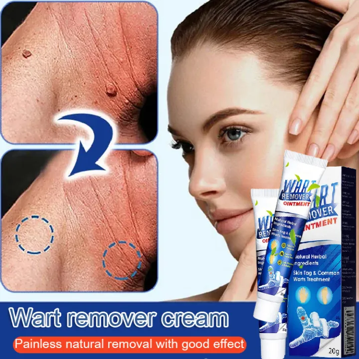 Super-Life Skin Tag Blue Tube Wart Removal Cream | Lazada PH