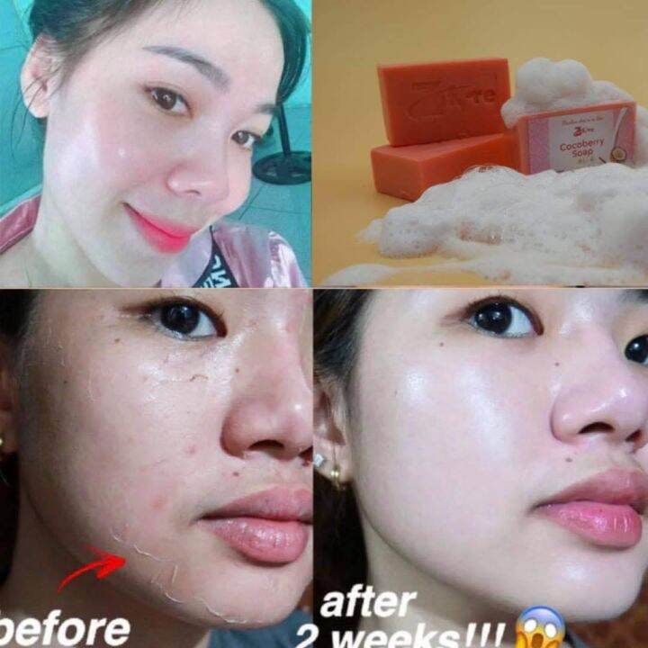 COCOBERRY BLEACH SOAP | 100%LEGIT NA SABON PAMPAPUTI PAMPAKINIS PWEDE SA BUONG KATAWAN IN JUST ...