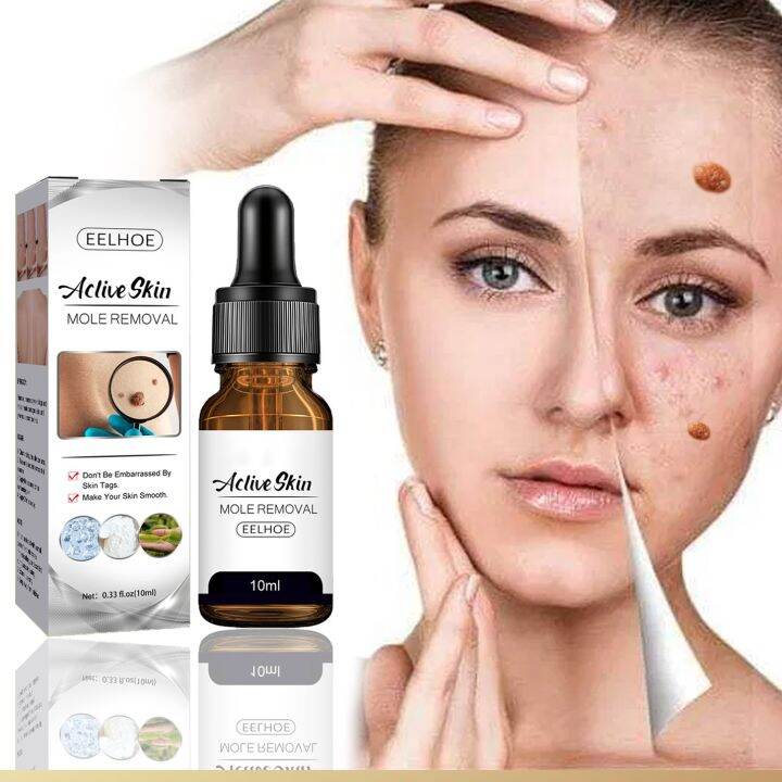 LL_Fashion Shop Aclive Skin Mole Removal Essence Skin Tag Remover Mole ...