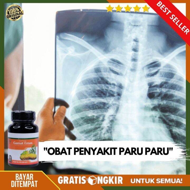 Obat Herbal Buat Penyakit Paru2 - Gejala Paru-Paru Basah, Radang Paru ...