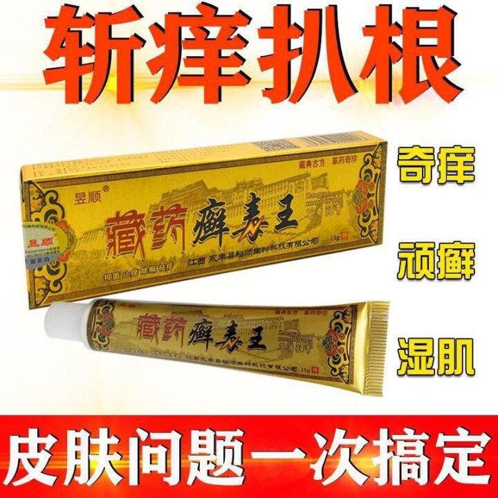 Psoriasis Herbal Cream/Gatal/Panau/Ekzima/Rashes/Ringworm/Fungus cream ...